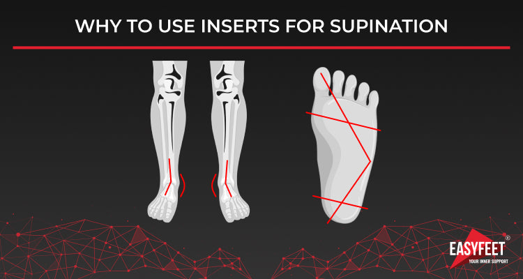 Benefits of Orthotics for Supination | Easyfeet – EASYFEET. Orthotic ...
