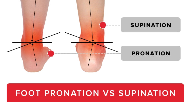 Foot Pronation vs. Supination | What is the difference – EASYFEET ...